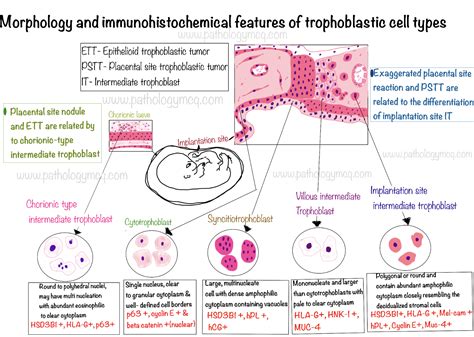 Pathology Mcqs For Various Entrance Exams