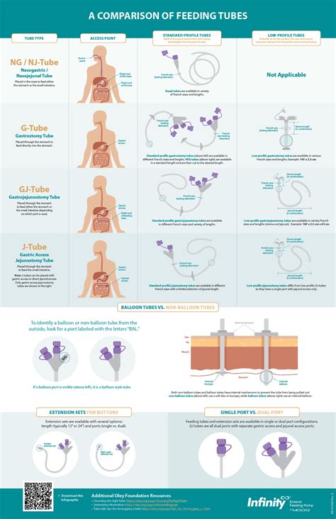Comparison Of Different Enteral Feeding Tubes And Configurations Moog Medical