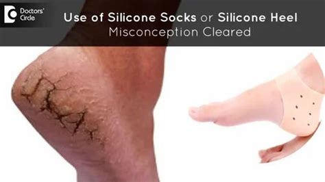 Skin Colour Silicon Hell Anti Crack Sets At Rs Piece In New Delhi