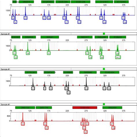 Representative Electropherograms Of The Sample 1 With A Typical Four