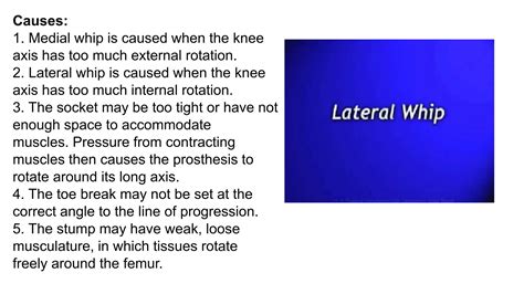 Transfemoral Prosthesis Gait Deviationspptx