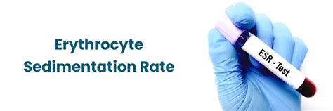 Understanding Erythrocyte Sedimentation Rate Key Facts