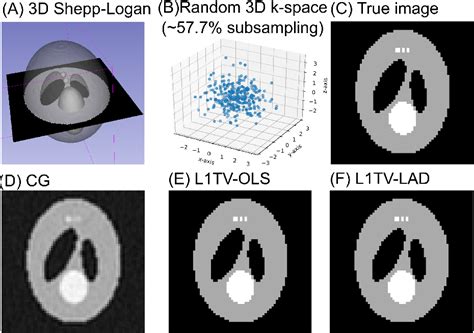 Figure 7 From Python Non Uniform Fast Fourier Transform Pynufft An