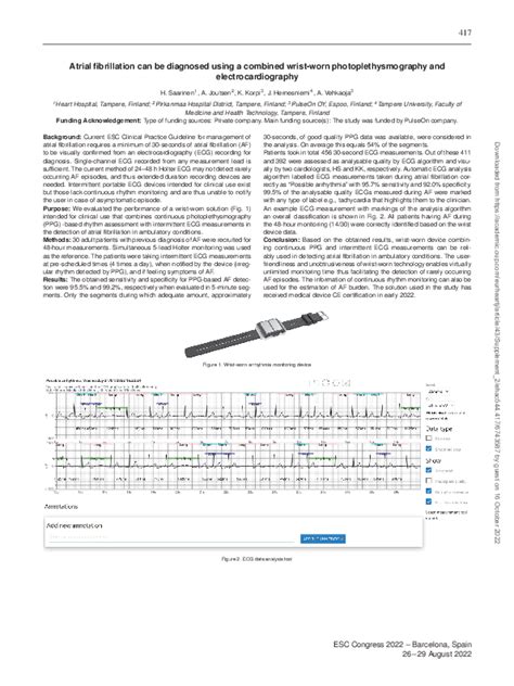 Pdf Atrial Fibrillation Can Be Diagnosed Using A Combined Wrist Worn Photoplethysmography And