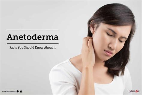 Anetoderma Facts You Should Know About It By Dr Sangeeta Varma Anetoderma Facts You Should Know About It By Dr Sangeeta Varma