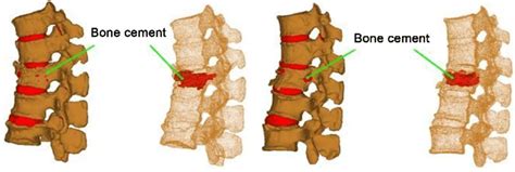 Finite Element Models A First Case B Second Case Download Scientific Diagram
