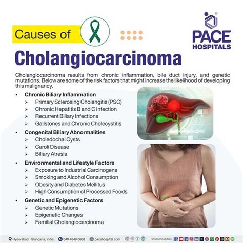 Cholangiocarcinoma Cancer The Recent Trends Of Systemic Treatments And