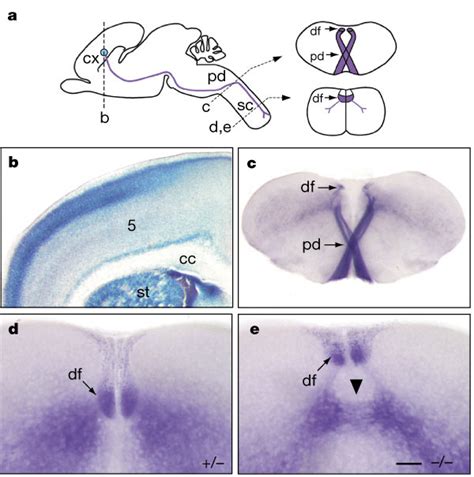 Axon Guidance Defects In Epha4 Mutantsa The Mouse Corticospinal Tract Download Scientific