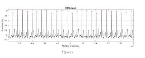 Using MATLAB Given The Recorded ECG Data Sampled At Chegg Com