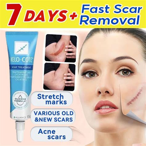 Kelo Cote Silicone Scar Gel 15g Scar Treatment For Large Burn Scars