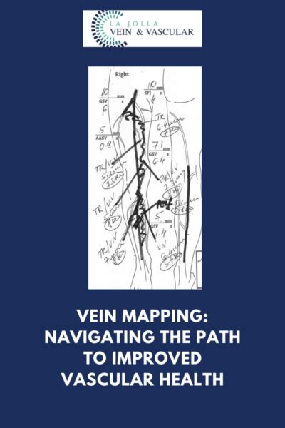 Vein Mapping Ultrasound Vein Mapping In Vascular Health