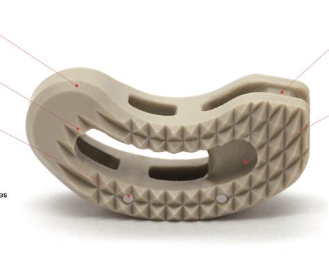 Caja De Fusión Lumbar Transforaminal Tlif Aravon Medical