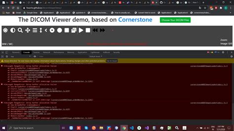 JPEGLS DCM File Not Opening With Error Issue Fourctv DicomViewerLib GitHub