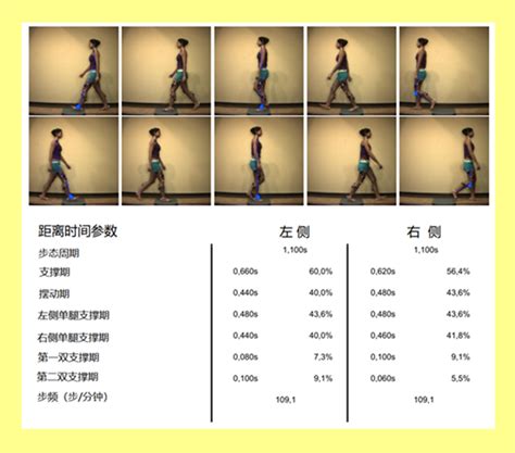 视频步态分析，治疗师的慧眼担当 普康科健