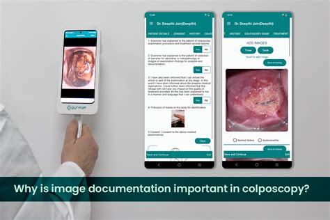 Why Is Image Documentation Important In Colposcopy Gyneye