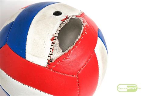 Filip Achkoski On Linkedin Како да препознаеме хернија кила кај