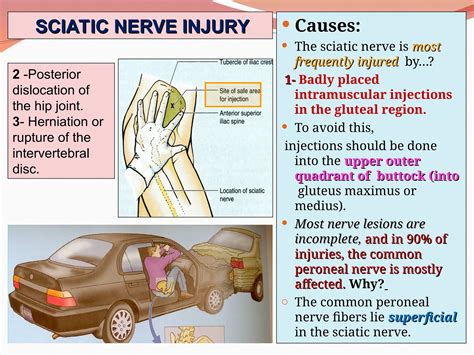 08anatomy Of The Sciatic Nerve And It Formation Ppt