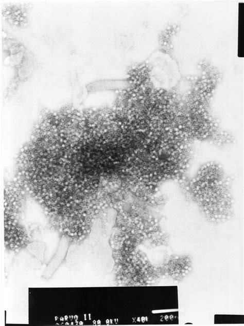 Negative Stain Electron Micrograph Of Recombinant Amdv Vp2 Vlps The Download Scientific