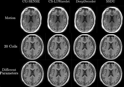 Here We Show Axial Brain Slice Reconstructions From Three Different