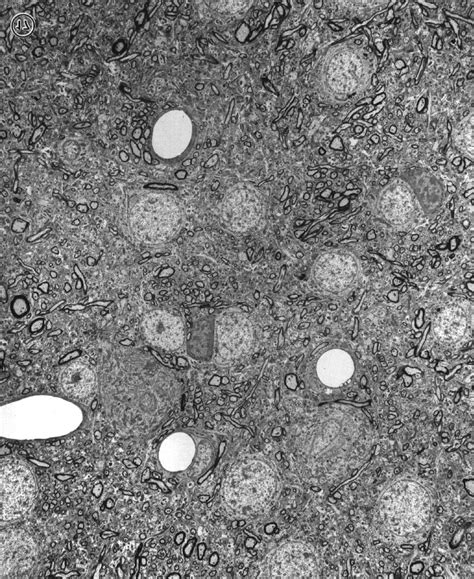 A Low Power Electron Micrograph Of A Thin Section Taken In The Download Scientific Diagram