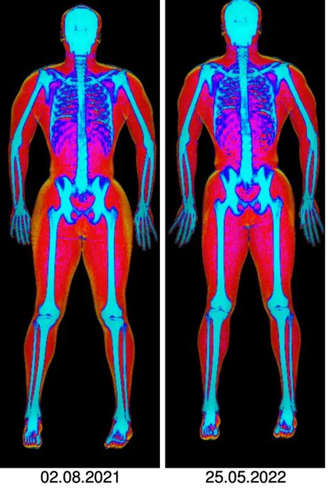 6 Tips For Gaining Muscle Mass Bodyscan