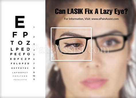 Can LASIK Fix A Lazy Eye