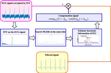 Figure 6 From Removal Of Power Line Interference From Ecg Signals Using Adaptive Notch Filters