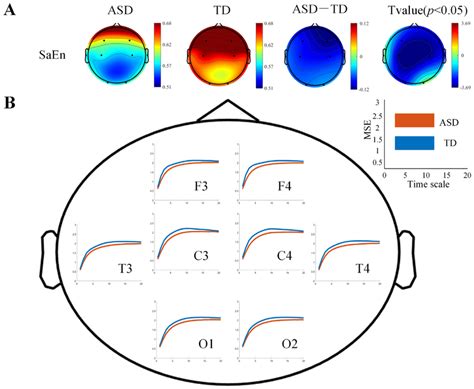 Comparison Of Eeg Complexity Differences Between The Two Groups Of