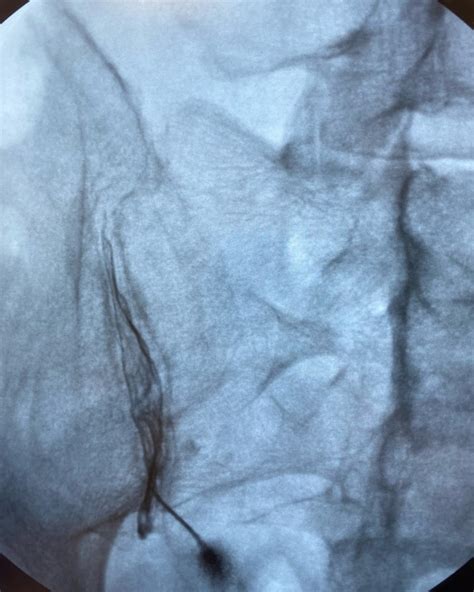 Jake Trahan Iii Md What An Incredible Feeling It Is To Receive A