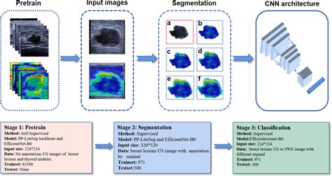 the process of model pretraining and segmentation network construction