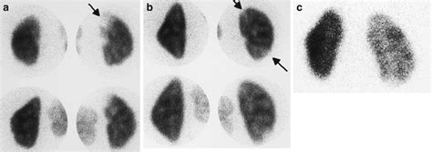 Renal Imaging Infection Radiology Key