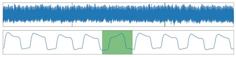 Is It Worth It Comparing Six Deep And Classical Methods For Unsupervised Anomaly Detection In