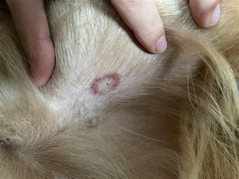 How Long Does A Tick Need To Bite Tp Transmit Lyme R Lyme