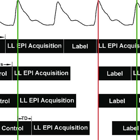 Pcasl Flip Angle Fa Sweep Labeling Efficiency And Brain Pcasl Signal Download Scientific