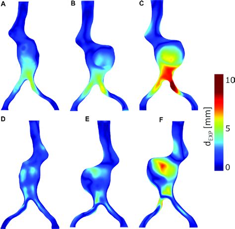 Experimental Deformations From Cbcts D Exp Anterior Views A Model Download Scientific