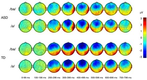 Scalp Maps Depicting Mean μv Within Every 100 Ms Window For Each Group