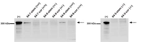 Western Blot Analysis Of Full Length 98q Htt Cdna Expression In Mice