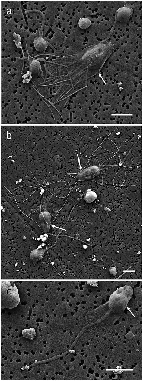 Example Sem Micrographs Of The Examined Morphotypes Of Cho White Download Scientific Diagram
