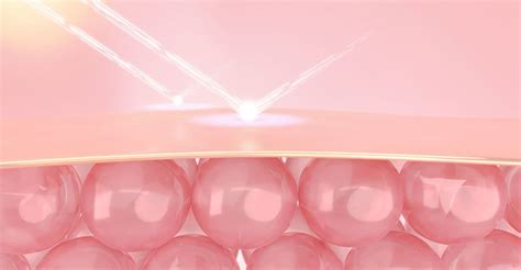 봄날피부과 선천성반점 클리닉