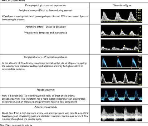 Figure 1 From Interpretation Of Peripheral Arterial And Venous Doppler