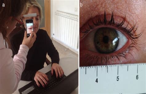 Neuro Tools Spotlight From Pupil Exam To Pupillary Size Measurement Getdailygossip Com