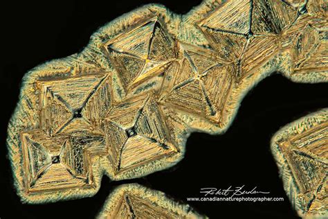 Vitamin B12 Crystals By Polarized Light Microscopy The Canadian