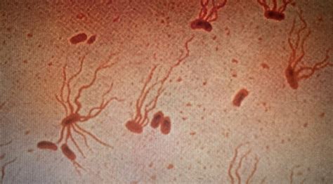 50 Facts About Typhoid