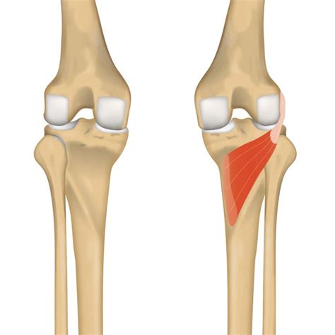 M Popliteus Präpapp Early Access