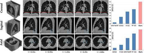 X {2} Gaussian 4d Radiative Gaussian Splatting For Continuous Time Tomographic Reconstruction