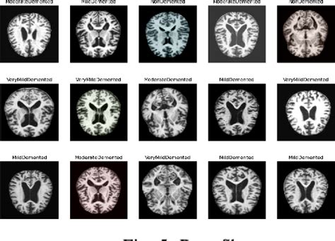 Figure 5 From Hybridized Convolutional Neural Networks And Long Short Term Memory For Improved