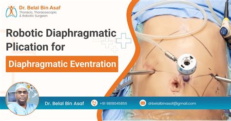 Difference Between Thoracotomy And Thoracostomy