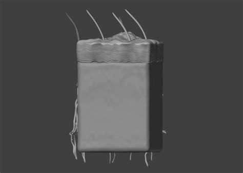 3d Model Of Psoriasis Skin Cross Section Other Organs