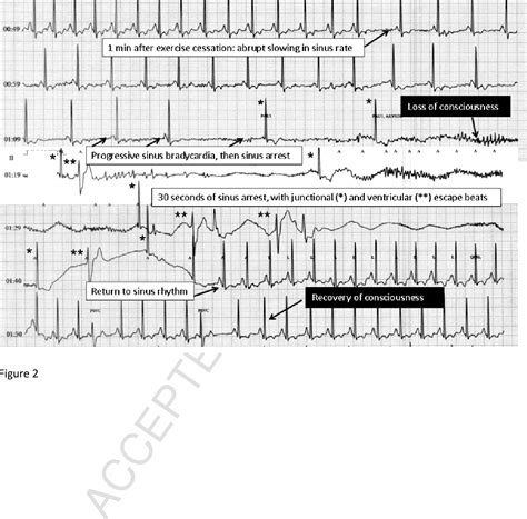 Figure 1 From Diagnostic Algorithm For Syncope Semantic Scholar