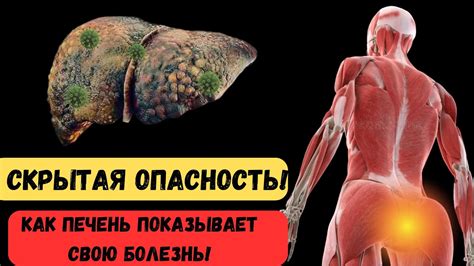 НЕ ИГНОРИРУЙТЕ Эти 8 Признаков ПРОБЛЕМЫ с ПЕЧЕНЬЮ как Разпознать Youtube